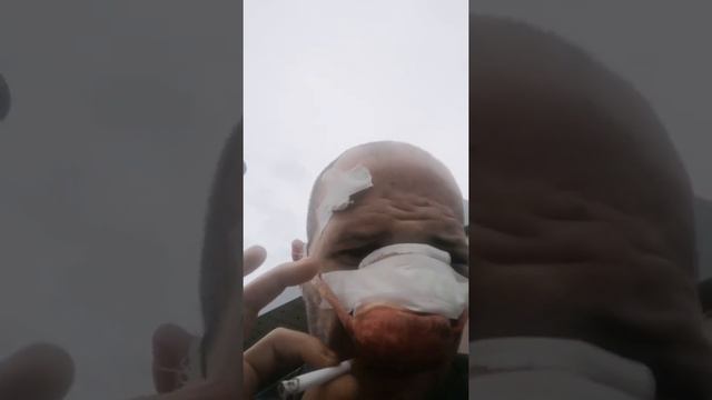 Цыган разбил нос Спону, чтобы не выкобенивался