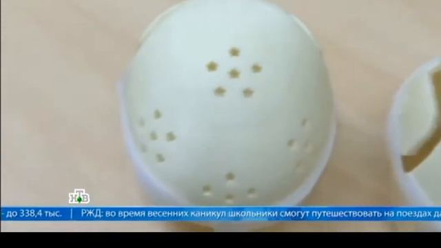 Лечение деформаций головы у ребенка с помощью шлемов