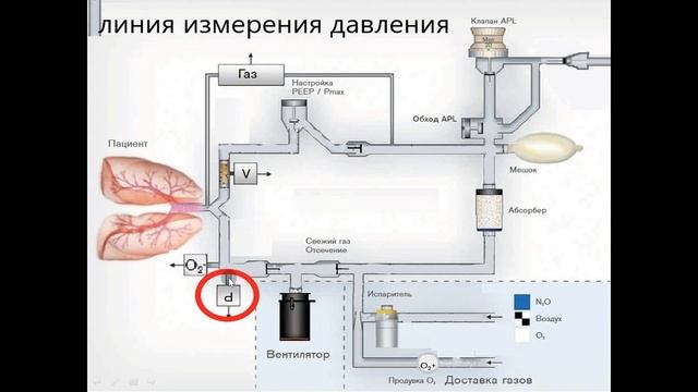 Устройство наркозного аппарата часть 1