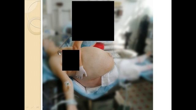 Трудные дыхательные пути часть 1