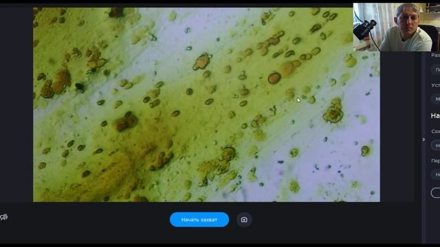 Что можно найти в мокроте из горла у человека.01.11.2024