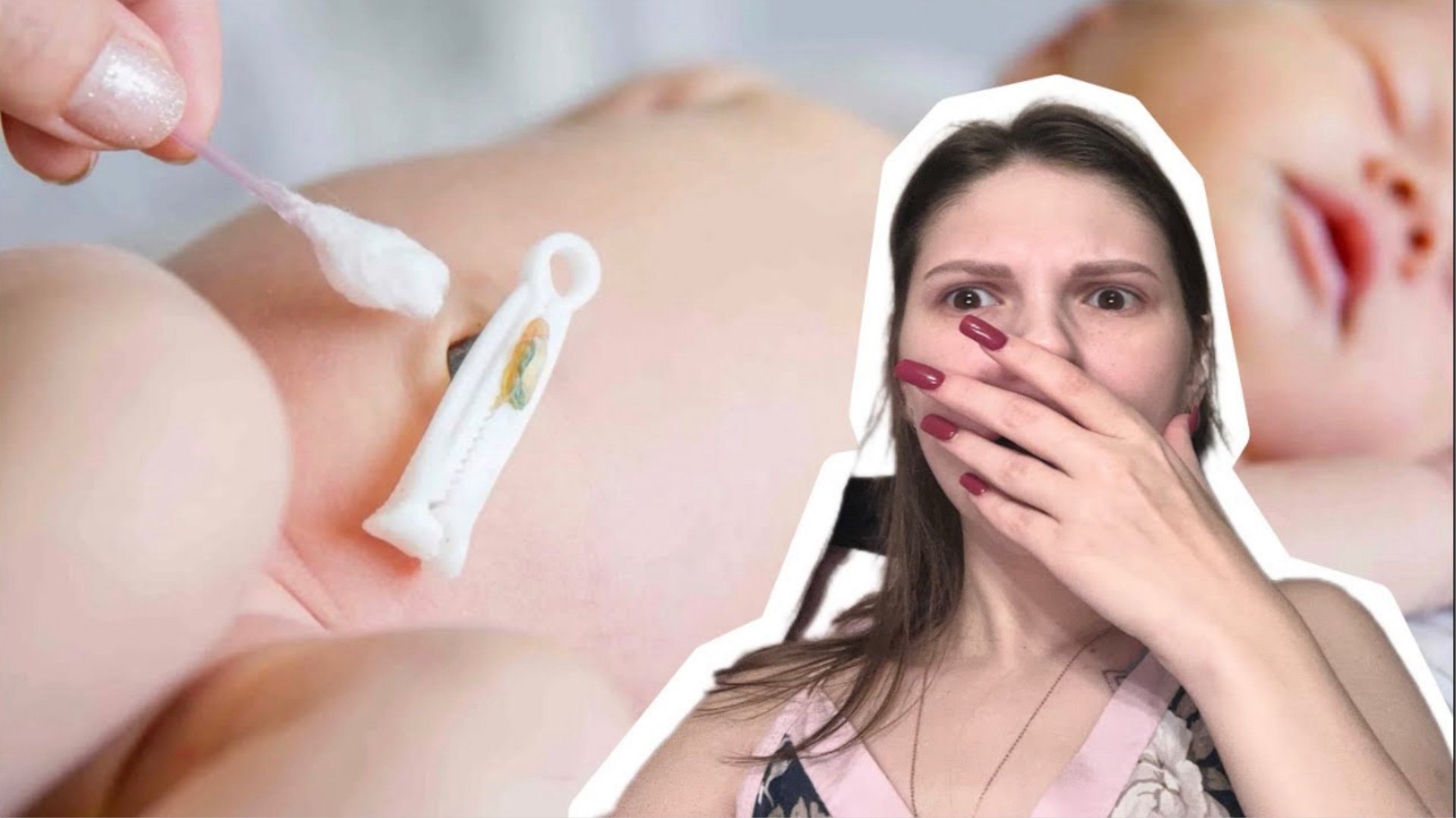 Как ухаживать за пупком новорождённого?!