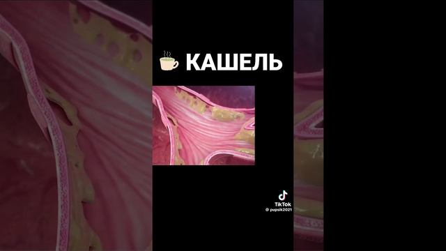лечение кашля