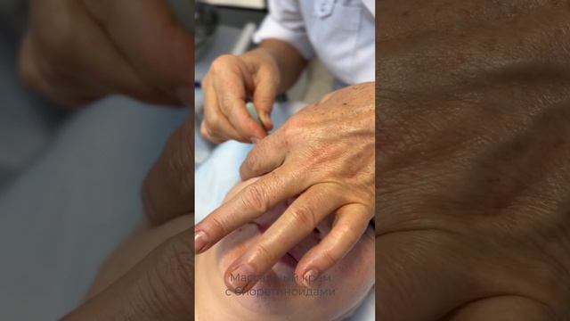 Протокол процедуры Retiderma Montibello