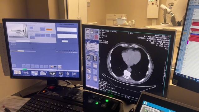 Компьютерная томография брюшной полости .mp4