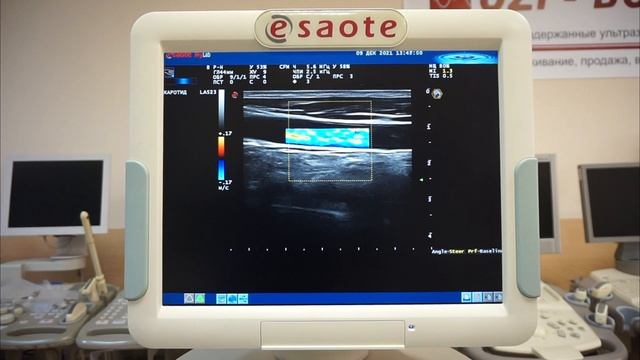 Esaote MyLab 70 обзор