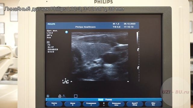 Philips HD11 XE обзор ультразвукового сканера