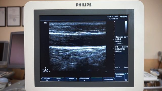 Philips HD7 обор ультразвукового сканера