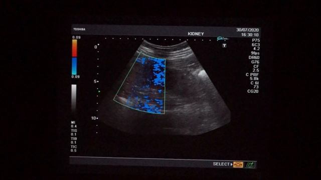 Toshiba Nemio XG обзор ультразвукового сканера