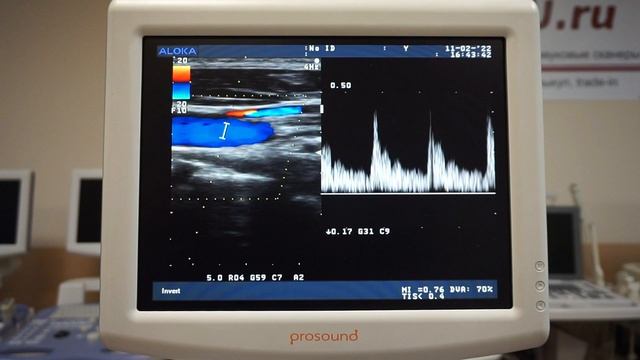 Aloka Alpha 5 обзор ультразвукового сканера