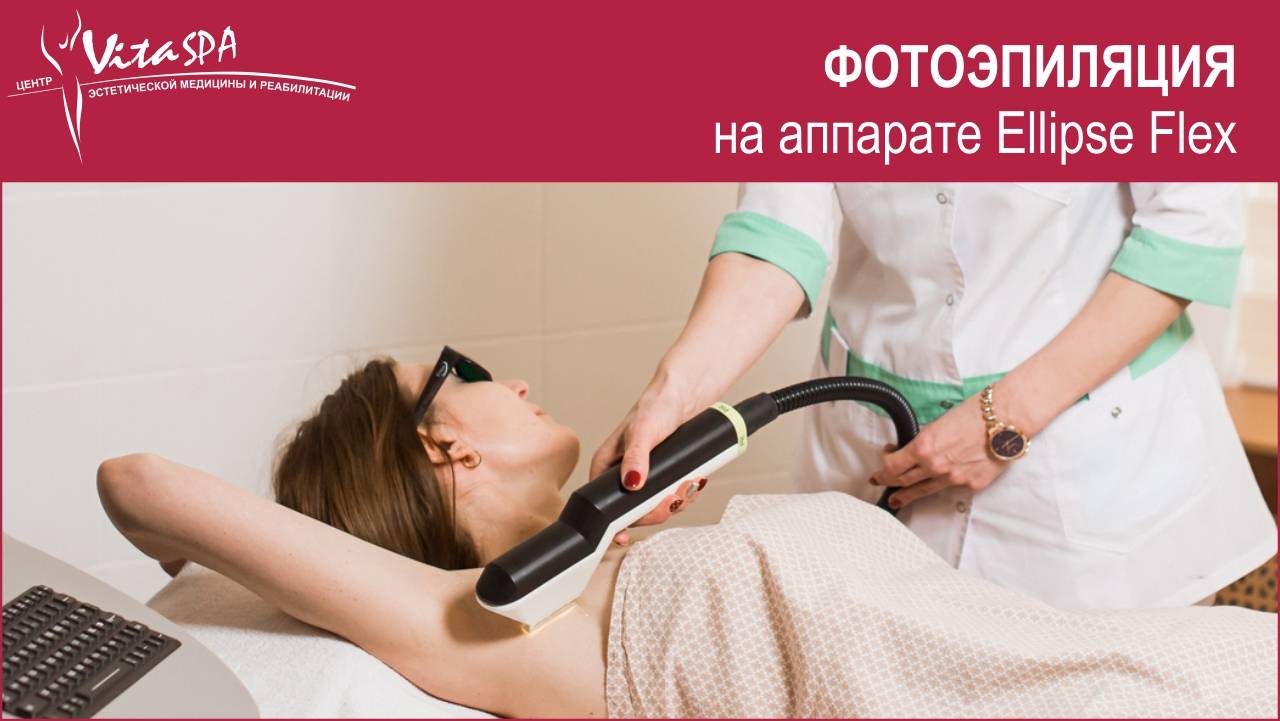 Фотоэпиляция