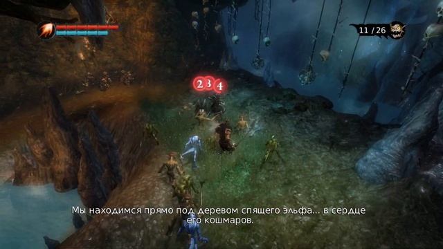 Overlord (15) - Одна ошибка