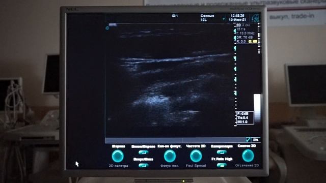 GE Vivid 3 обзор ультразвукового сканера