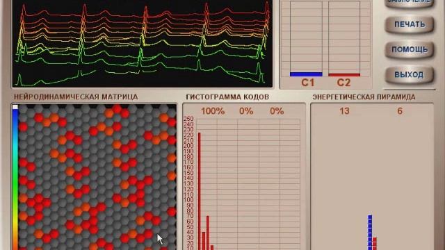 Результаты применения аппарата Сферион. Часть 1