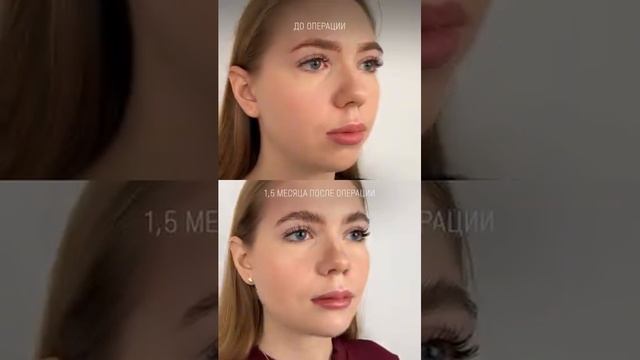 Челюстно-лицевая хирургия: решение ваших эстетических проблем