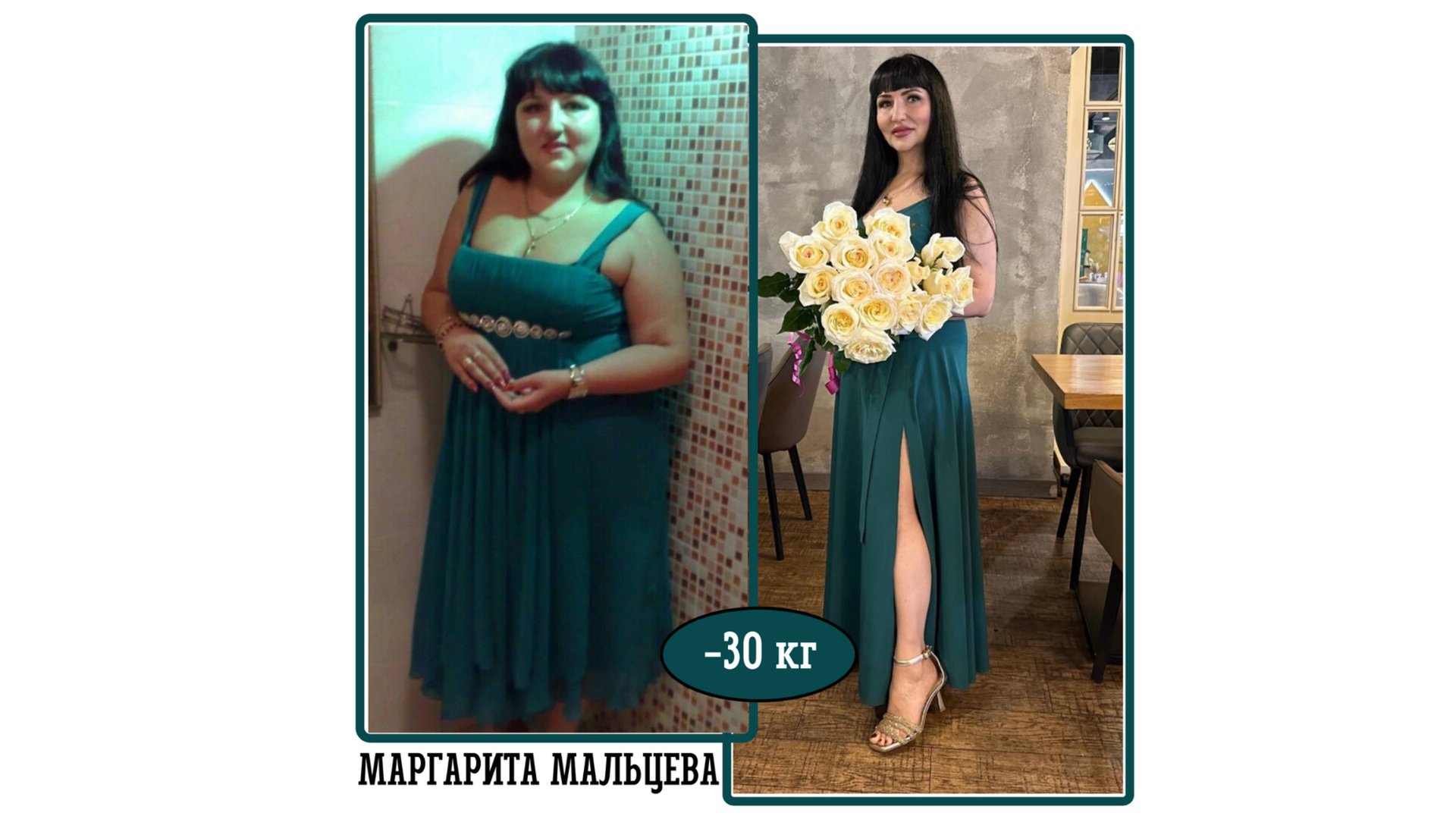 Маргарита Мальцева. До После -30 кг. Стройность с Доктором Кондрашовым