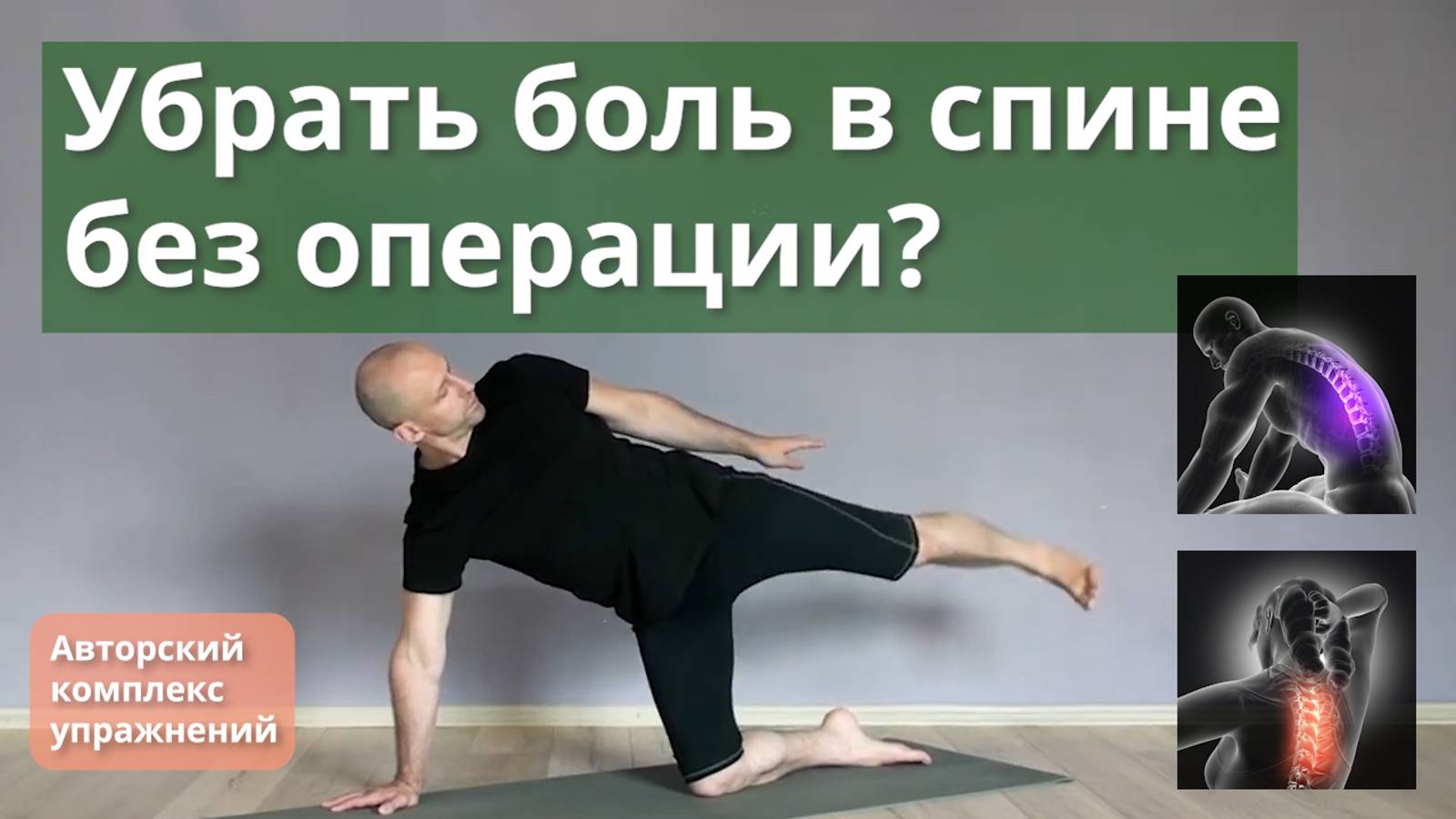 Лечение грыжи без операций. Что делать и что знать? Прогибы. Комплекс упражнений для позвоночника.