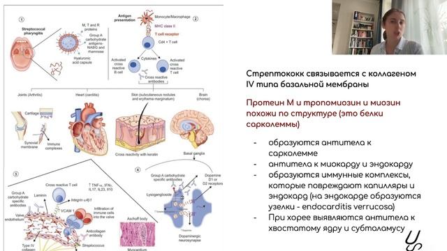 Терапия | Кардиология. Нарушения ритма и проводимости. Пороки сердца. Острая ревматическая лихорадка