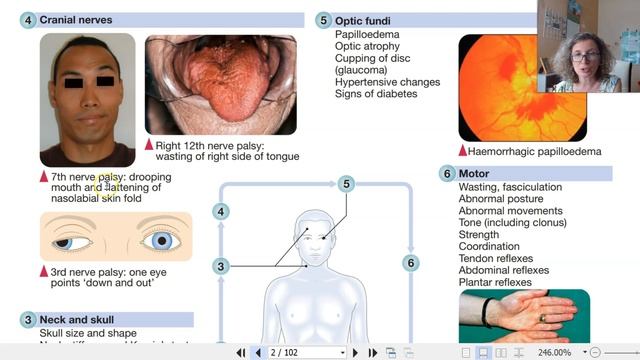 НЕВРОЛОГИЧЕСКИЙ ОСМОТР (Пример урока). Медицинский английский с Татьяной Глушковой