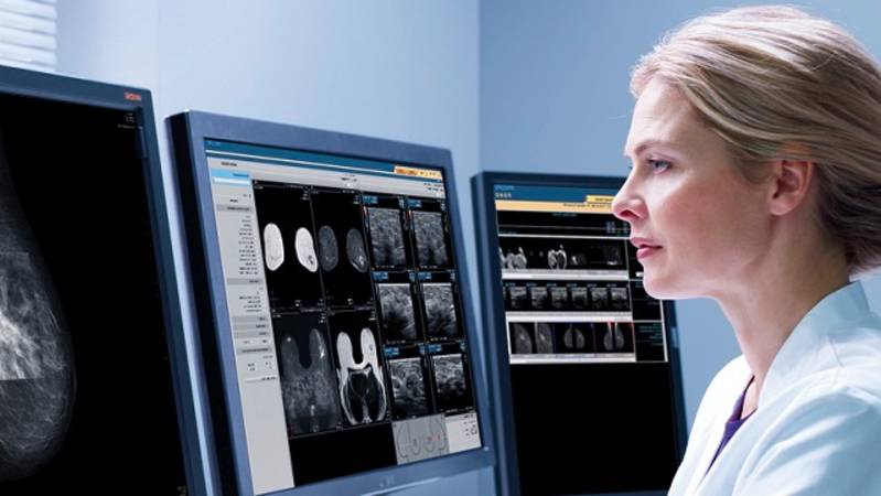 КАК ВЫГЛЯДЕТ РАК НА МАММОГРАФИИ. ИУСТАФИН ЧИНГИС 79104653497 КУРС МАММОЛОГИИ