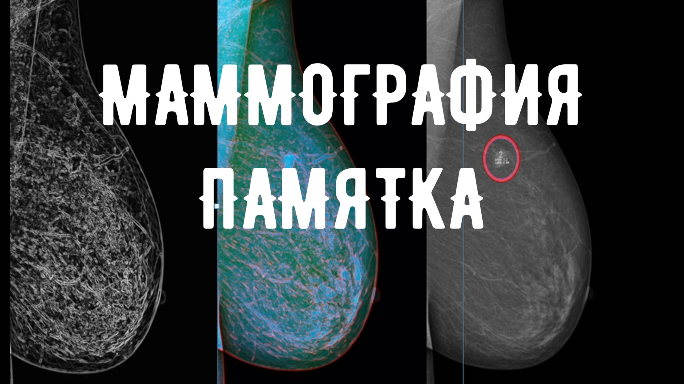 МАММОЛОГИЧЕСКИЙ СКРИНИНГ МУСТАФИН ЧИНГИС 79104653497 КУРС МАММОЛОГИИ