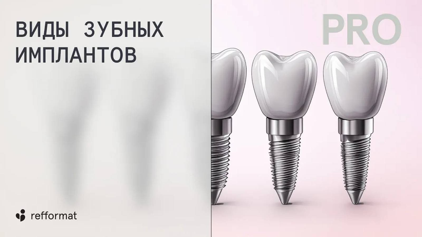 🦷👀 Виды зубных имплантов