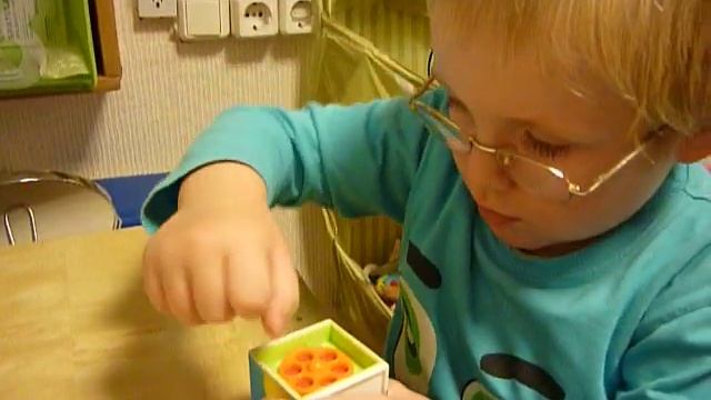 Дизартрия. Нарушение речи дизартрия. Практическое занятие.