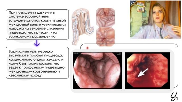 Топографическая анатомия воротной вены | Порто-кавальные анастомозы. Оперативная хирургия