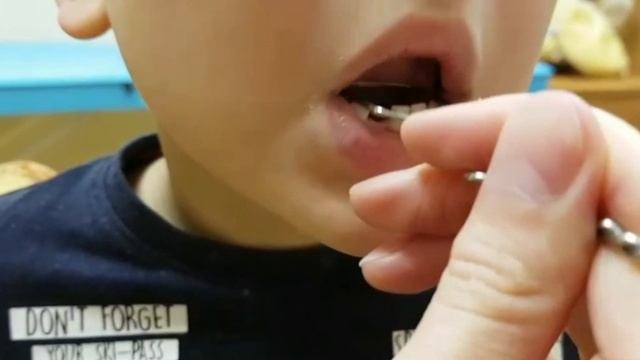 Звуки  К, Г, Кь, Гь. Постановка звука Кь механическим способом. Часть 2