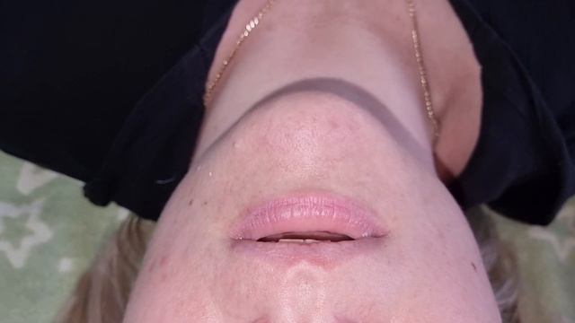 Дизартрия. Почему язык отклоняется в сторону?