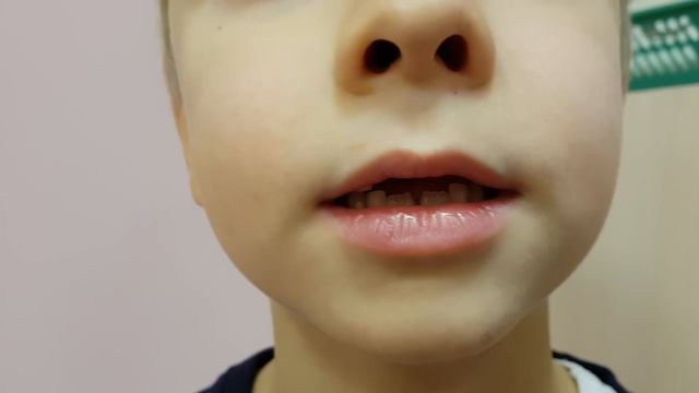 Короткая уздечка языка. Как влияет на произношение звуков? Диагностика  Часть № 1