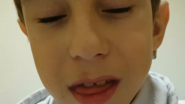 Звуки Т, Д.  Постановка звуков при дизартрии. Дизартрия