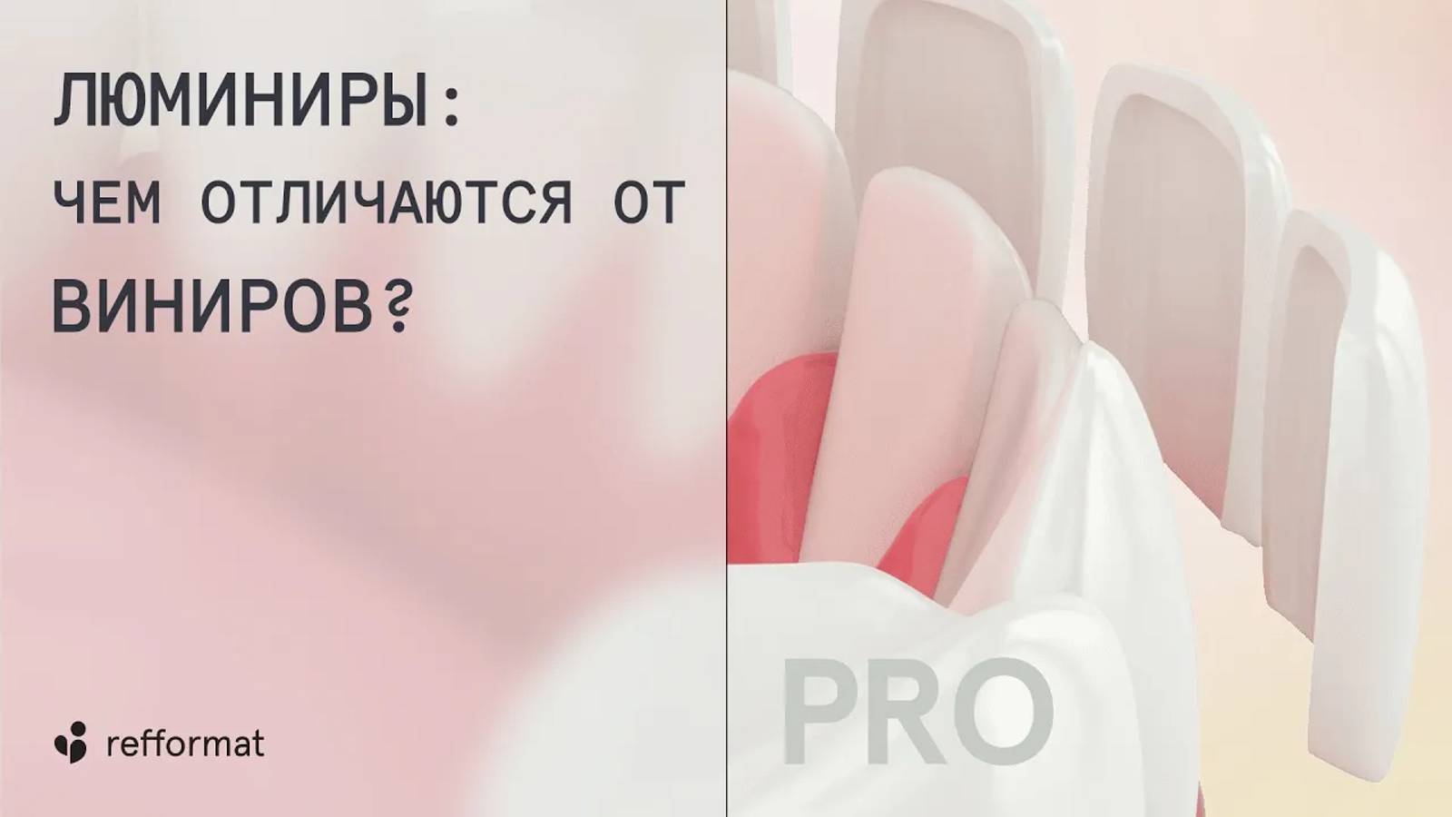 Люминиры. Чем отличаются от виниров.