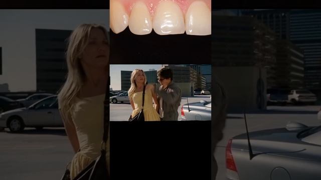 Реставрация зубов: до и после — потрясающие преображения!