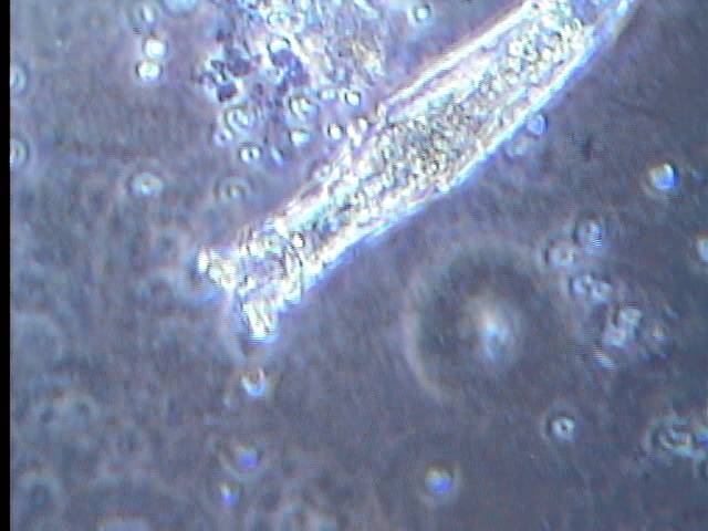 Коловратка - ненасытный пылесос | Rotifer - insatiable vacuum cleaner