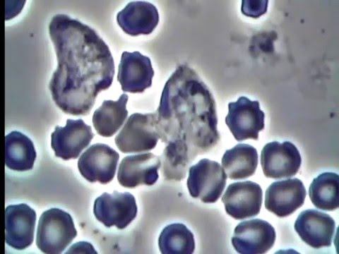 Кровь и макрофаг под микроскопом (Фазовый-контраст) | Blood and macrophage under a microscope