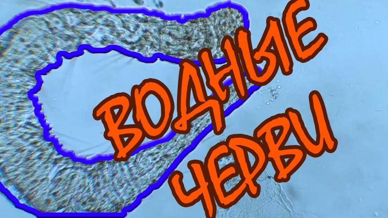 Червь Эолосома | Worm Aelosoma hemprichi / Increase to the maximum!