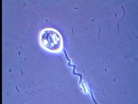 Инфузория Vorticella | Infusoria Vorticella