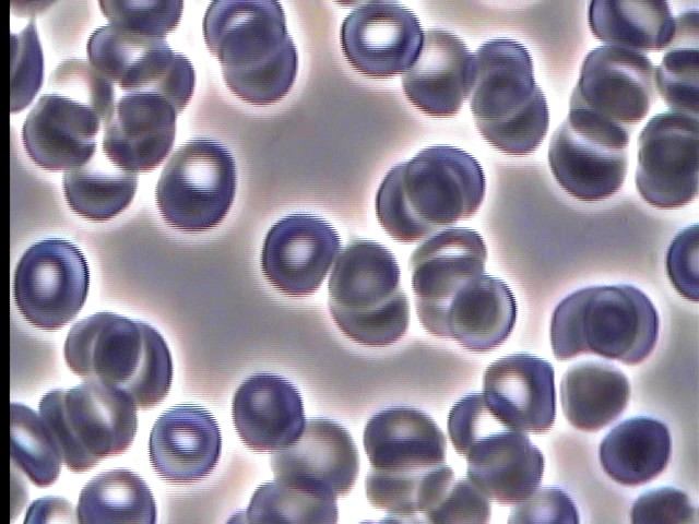 Кровь нормальное состояние | Blood normal condition