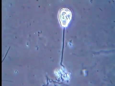 Инфузория Сувойка (Vorticella)