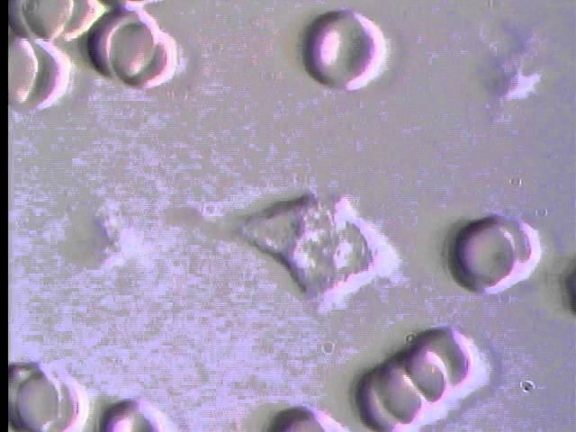 Движение макрофага (лейкоцита) в крови | Movement of the macrophage (leukocyte) in the blood