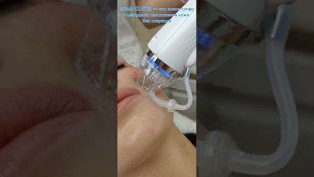 Новый, эффективный, игольчатый РФ лифтинг от ЭСМА