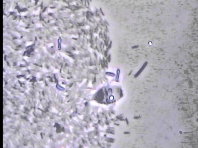 Микроорганизмы под микроскопом-водная среда | Microorganisms under the microscope-water environment