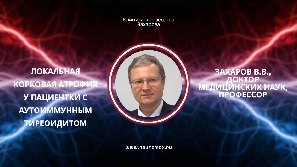 Локальная корковая атрофия у пациентки с аутоиммунным тиреоидитом