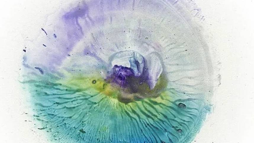 МАСТОПАТИИ 7/3  ПРОФЕССОР КИЖАЕВ Е.В