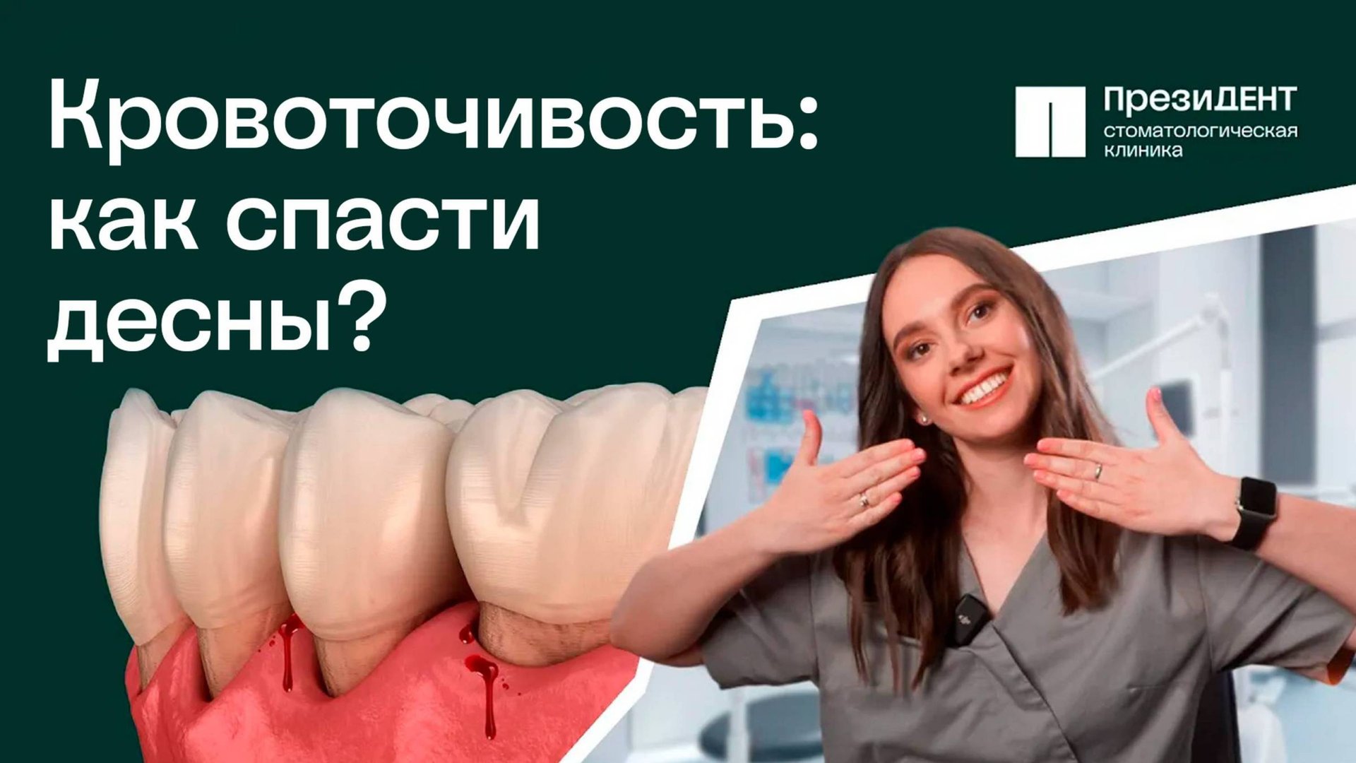 Болят десна! Симптомы, причины, виды болезней десен, способы лечения.⚡️ |Стоматология ПрезиДЕНТ 💚