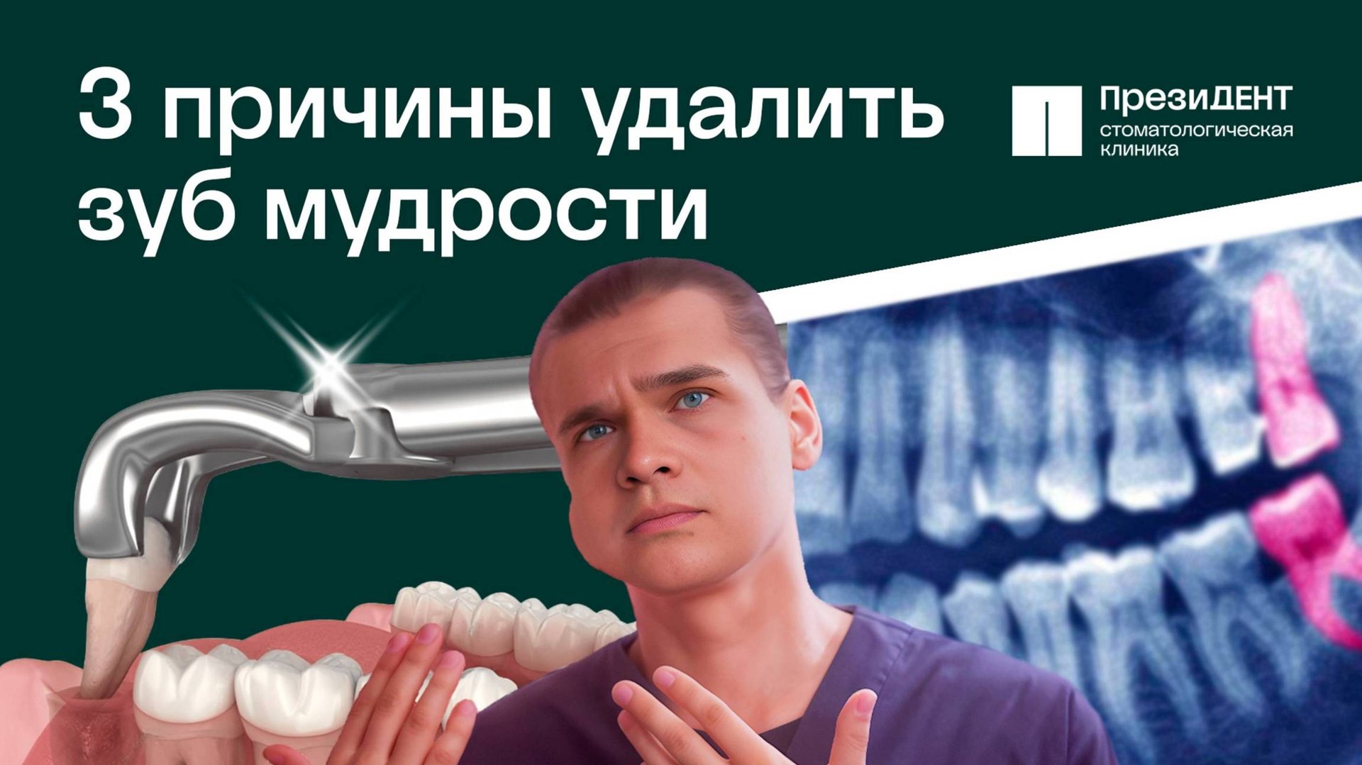 Зуб мудрости: удалять или нет? 🔧🦷 | Отвечает стоматолог сети клиник ПрезиДЕНТ💚