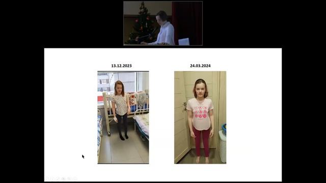 Нейрохирургические методы коррекции двигательных нарушений