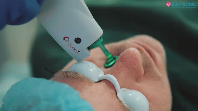 Лазерное удаление купероза в исполнении сосудистого хирурга