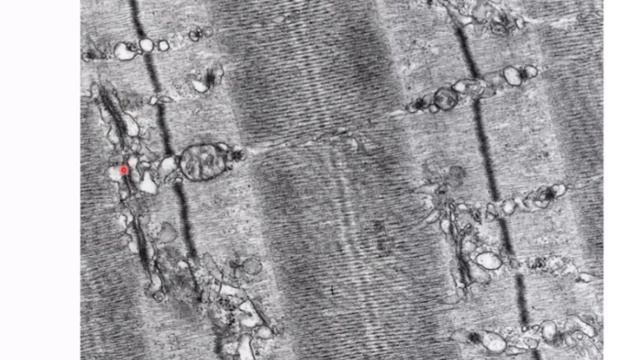 Лекция 8. Мышечные ткани | Глинкина В.В.